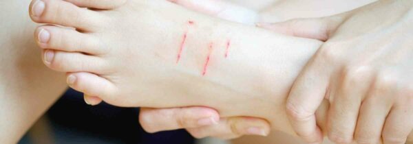 How Long Does a Tetanus Jab Last - Midnight Pharmacy